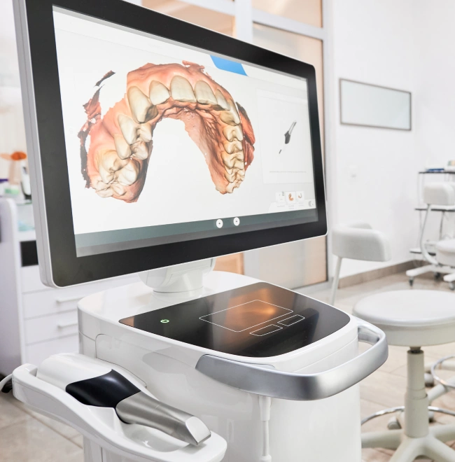 Intraoral Cameras Newport Beach, CA | Watson, Niven, Skahen ...